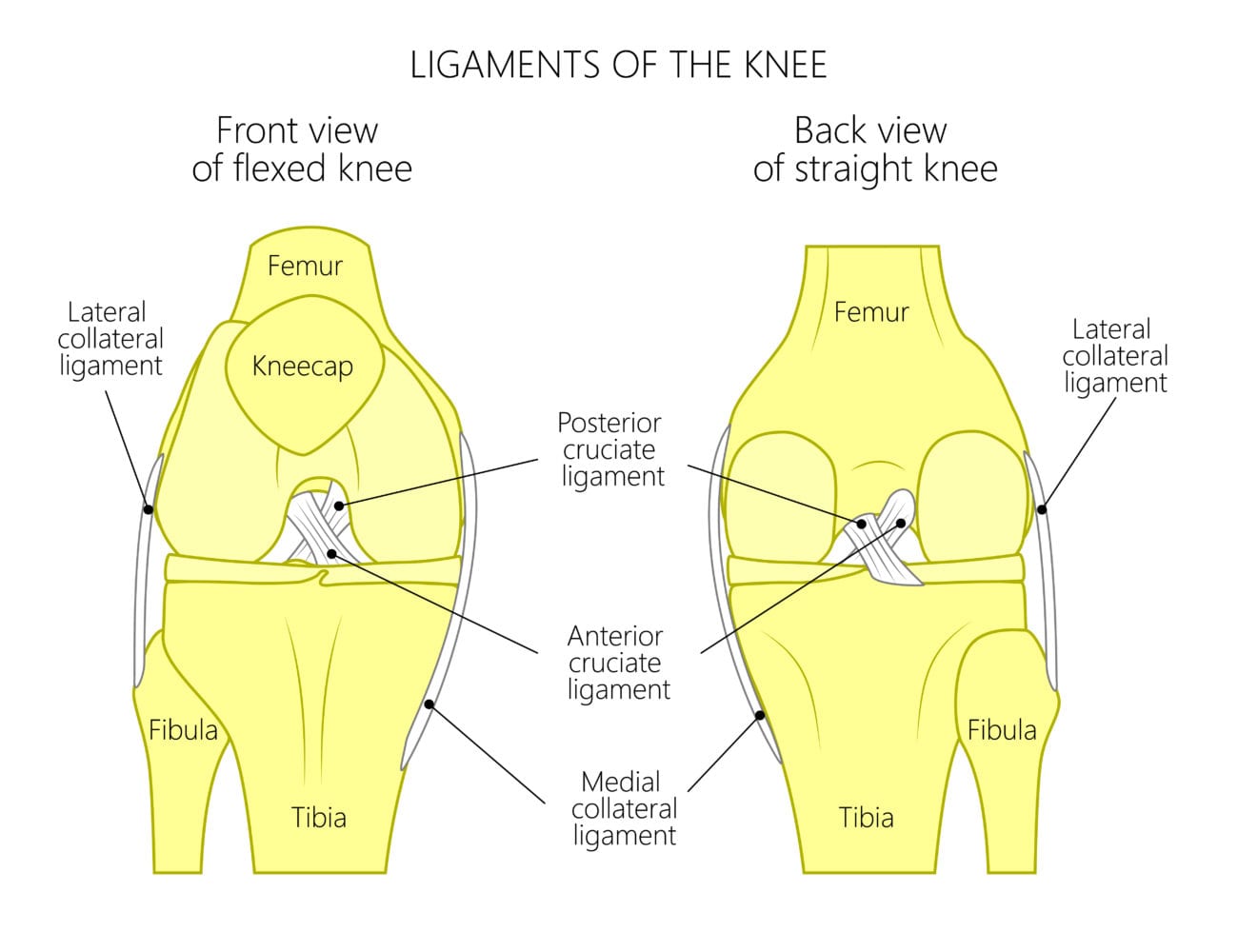Ligamen Lutut Koyak Tak Sembuh Dengan Mengurut - Flexphysiotherapy