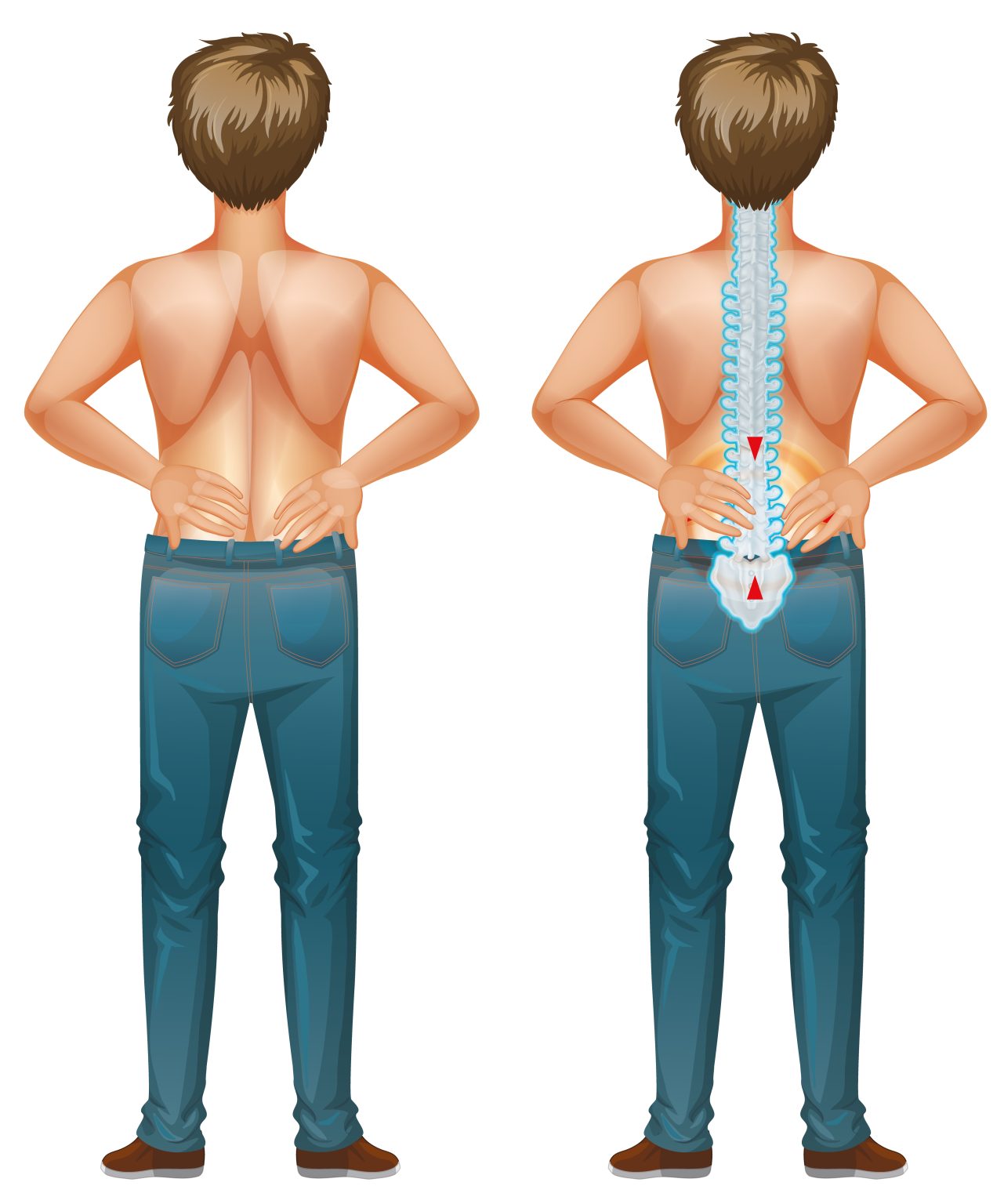 Kurangkan sakit pinggang dengan posisi tidur - Flexphysiotherapy