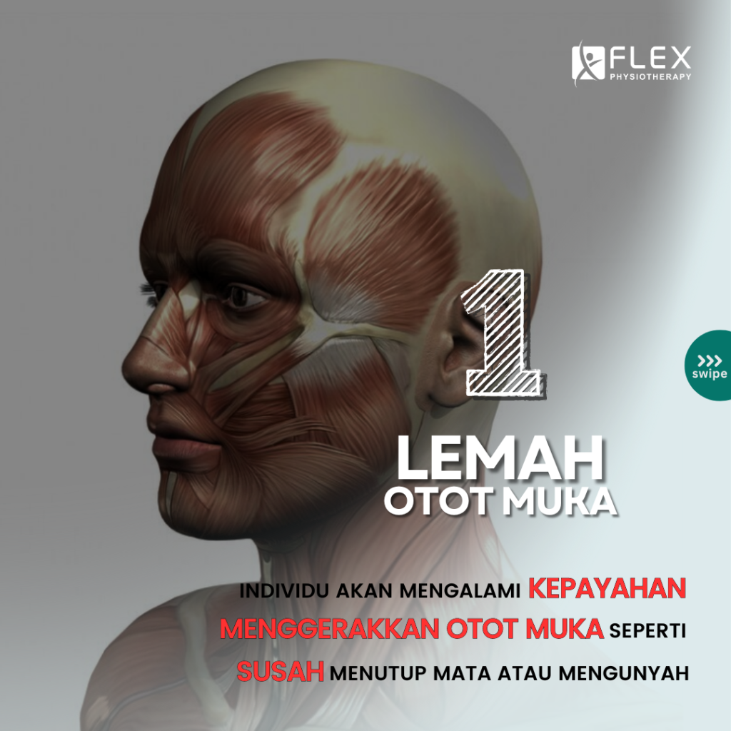 Bell's Palsy: Simptom Awal Yang Perlu Anda Ketahui! - Flexphysiotherapy