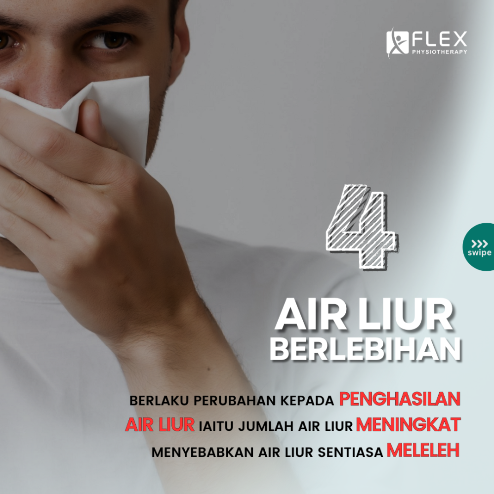 Bell's Palsy: Simptom Awal Yang Perlu Anda Ketahui! - Flexphysiotherapy