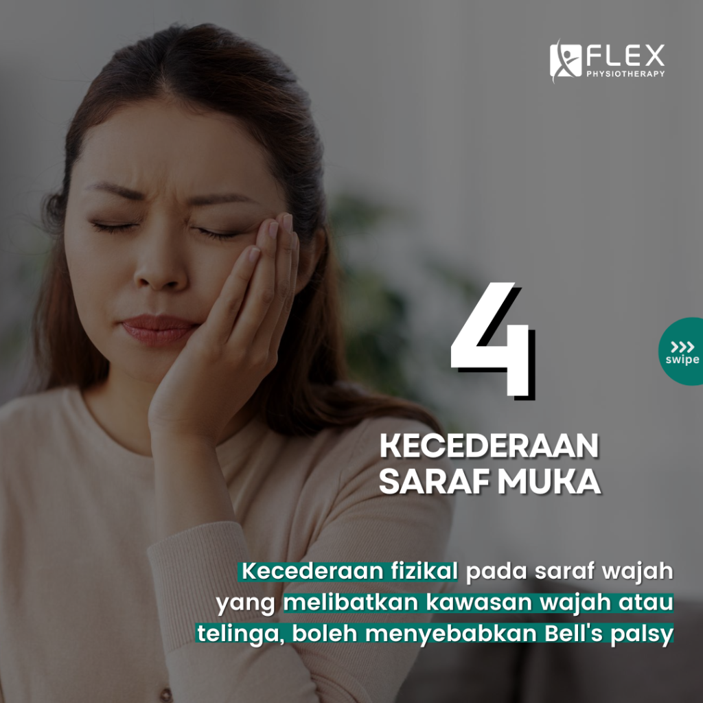 Bell's Palsy: Apa Punca Sebenar? - Flexphysiotherapy